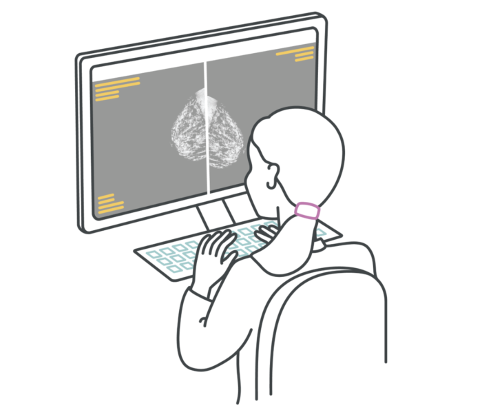 Task Force Advises Starting Mammograms At 40 - Anne Peled, MD